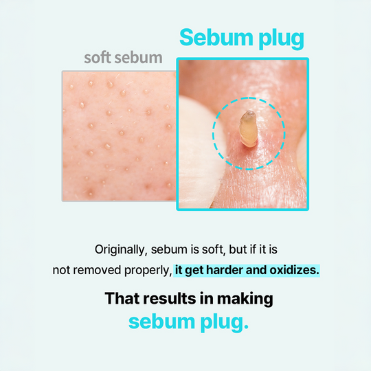 ILSO Super Melting Sebum Softener (150g) – PURESEOUL