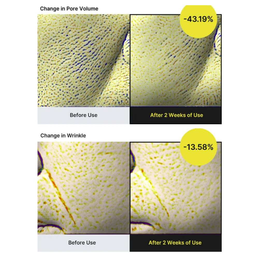 CELIMAX The Vita-A Retinol Shot Tightening Serum (30ml) – PURESEOUL